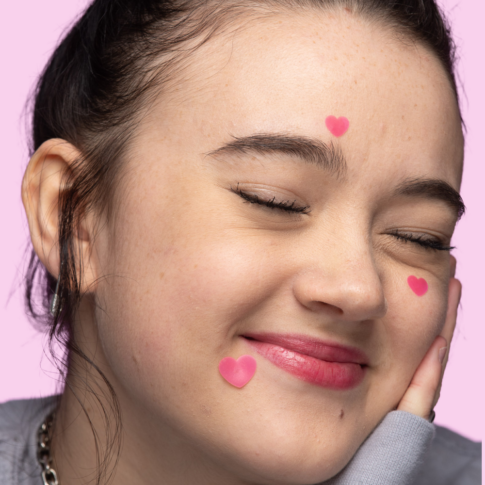 Zap Zits with Frilliance Pimple Patches